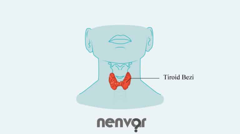 TSH Nedir? TSH Yüksekliği Nedir? Nedenleri ve Belirtileri